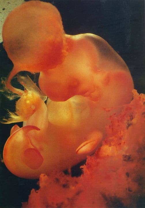 7 weeks 3 days pregnant - Baby Fetal Progress, Symptoms, Precautions ...