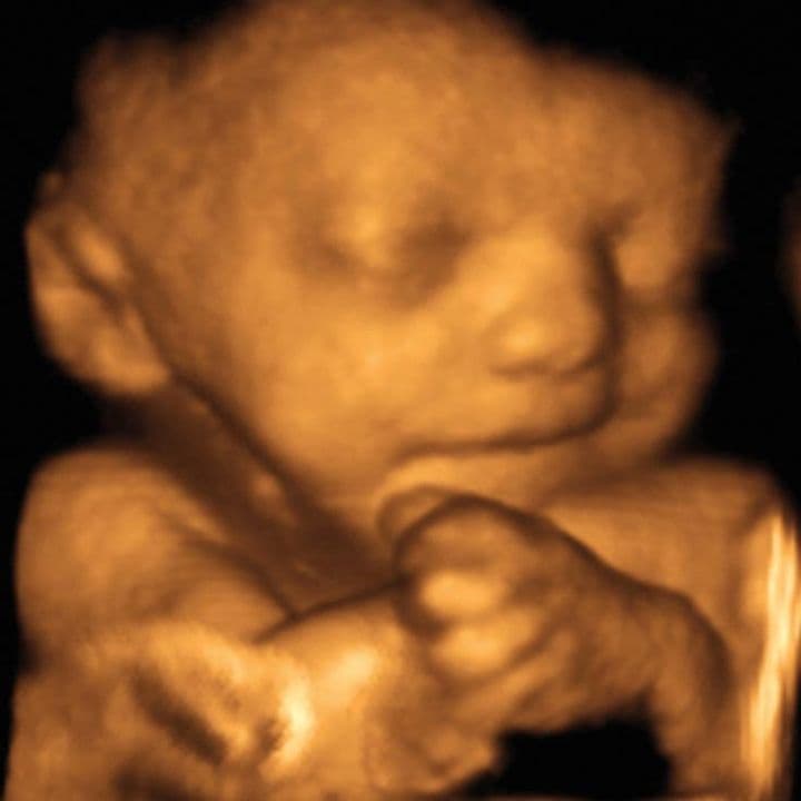 32 weeks and 2 days pregnant - Baby Fetal Progress, Ultrasound ...